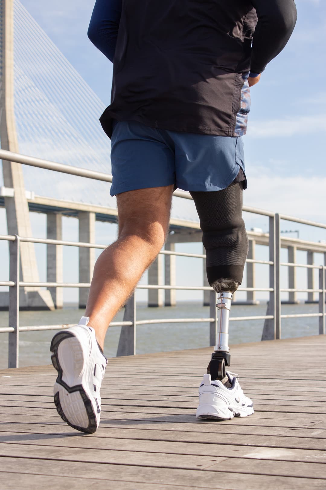 Life and Limb - Prosthetic Limbs for Those in Need | India